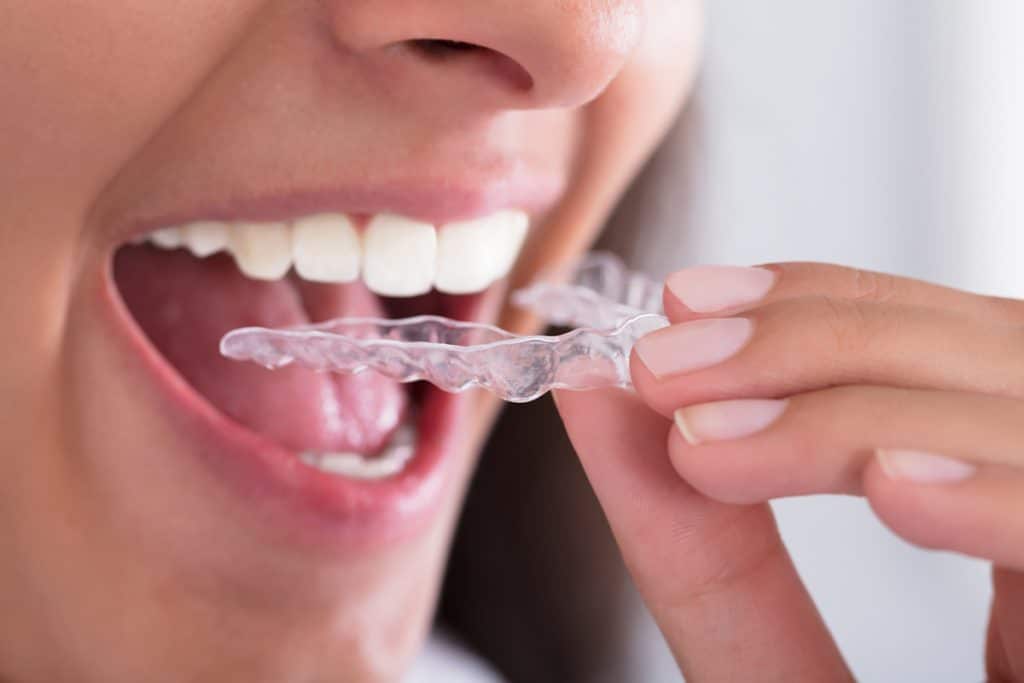 Does Invisalign Hurt? | Signature Orthodontics